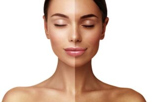 Bronzers Vs Intensifiers: What's The Difference Between These Tanning ...